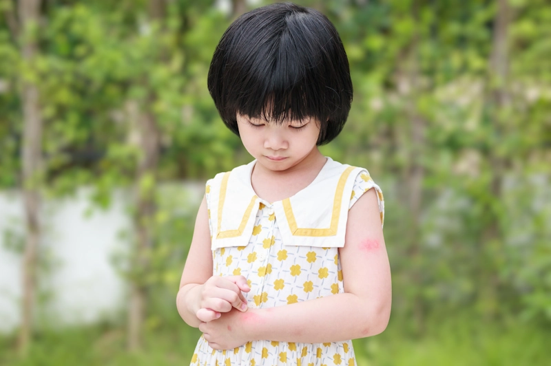 Chickenpox Itching: How to Stop Your Child from Scratching | Pantai ...